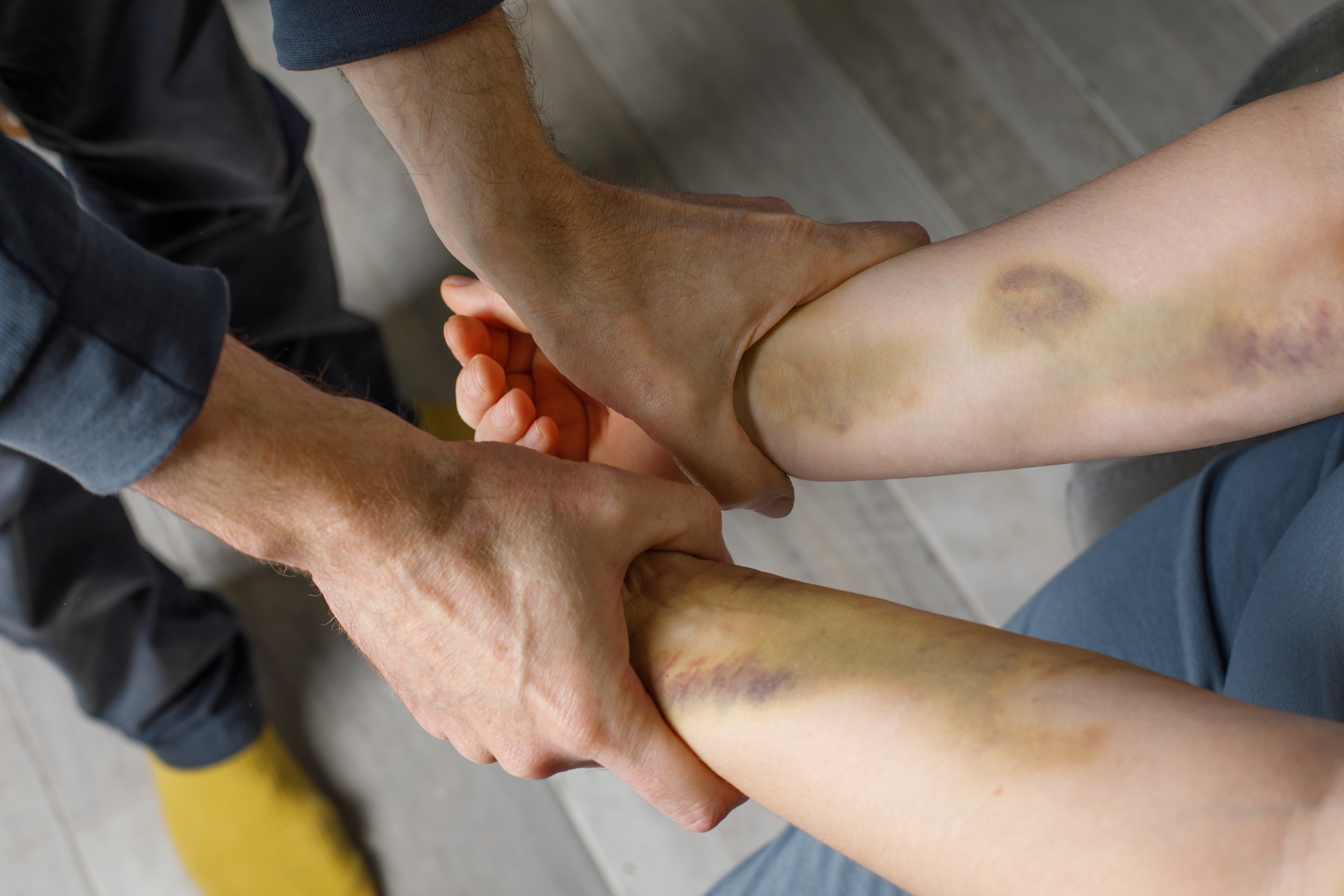 Felony Assault in Wagoner - Oklahoma Criminal Defense Lawyers